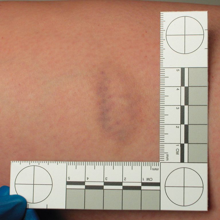 Photomacrographic Scale – Wsci-Technology